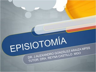 Episiotomia | PPTX