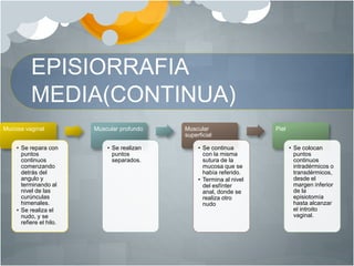 Episiotomia | PPTX