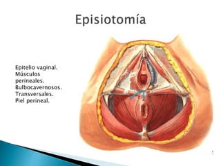Episiotomia Pptx