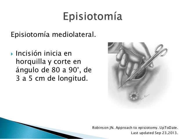 Episiotomia