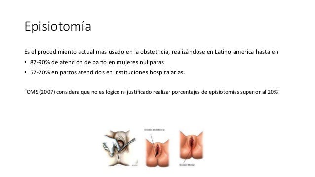 Episiotomia y Episiorrafia