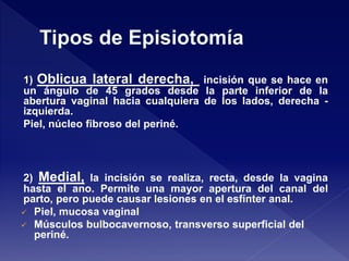 episiotomia , tipos de episiotomia, periné | PPTX