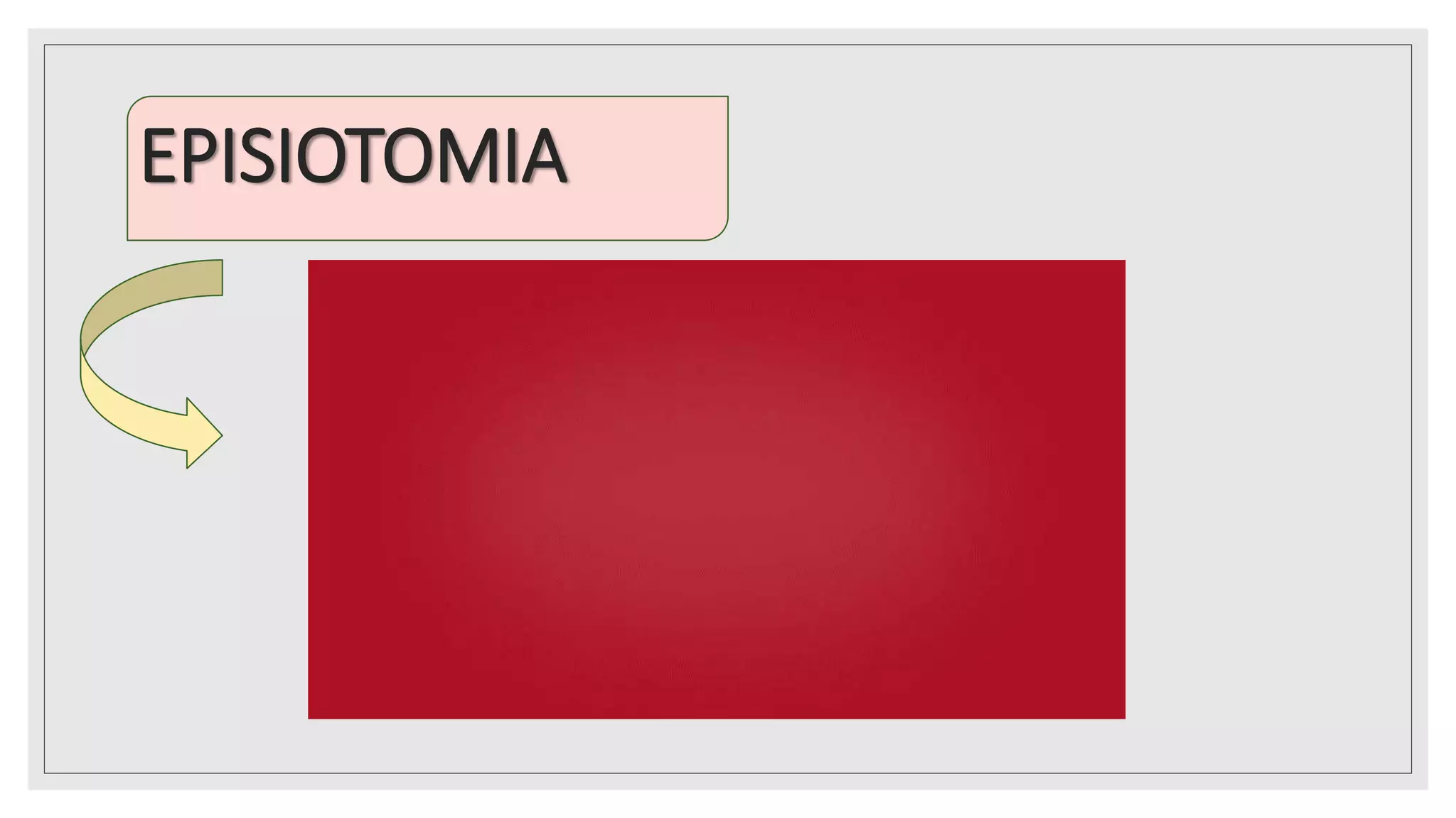 EPISIOTOMIA BERENNI CORTES RDY.pptx