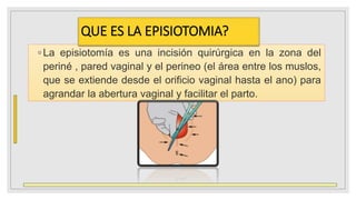 EPISIOTOMIA BERENNI CORTES RDY.pptx