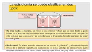 EPISIOTOMIA BERENNI CORTES RDY.pptx