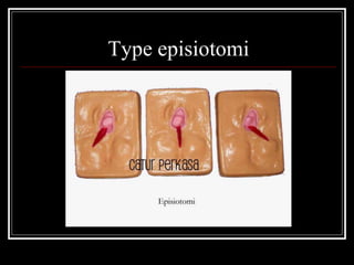 EPISIOTOMI_and_AMNIOTOMI.ppt
