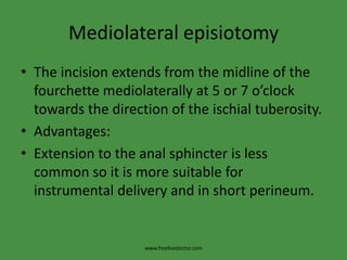 Episiotomy | PPTX