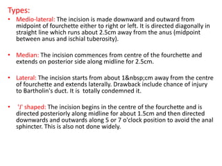 Episiotomy | PPTX