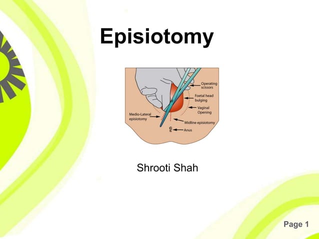 Episiotomy | PPTX | Pregnancy | Reproductive Health