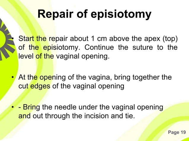 Episiotomy | PPTX | Pregnancy | Reproductive Health
