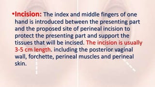Episiotomy | PPTX