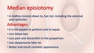 Episiotomy | PPTX