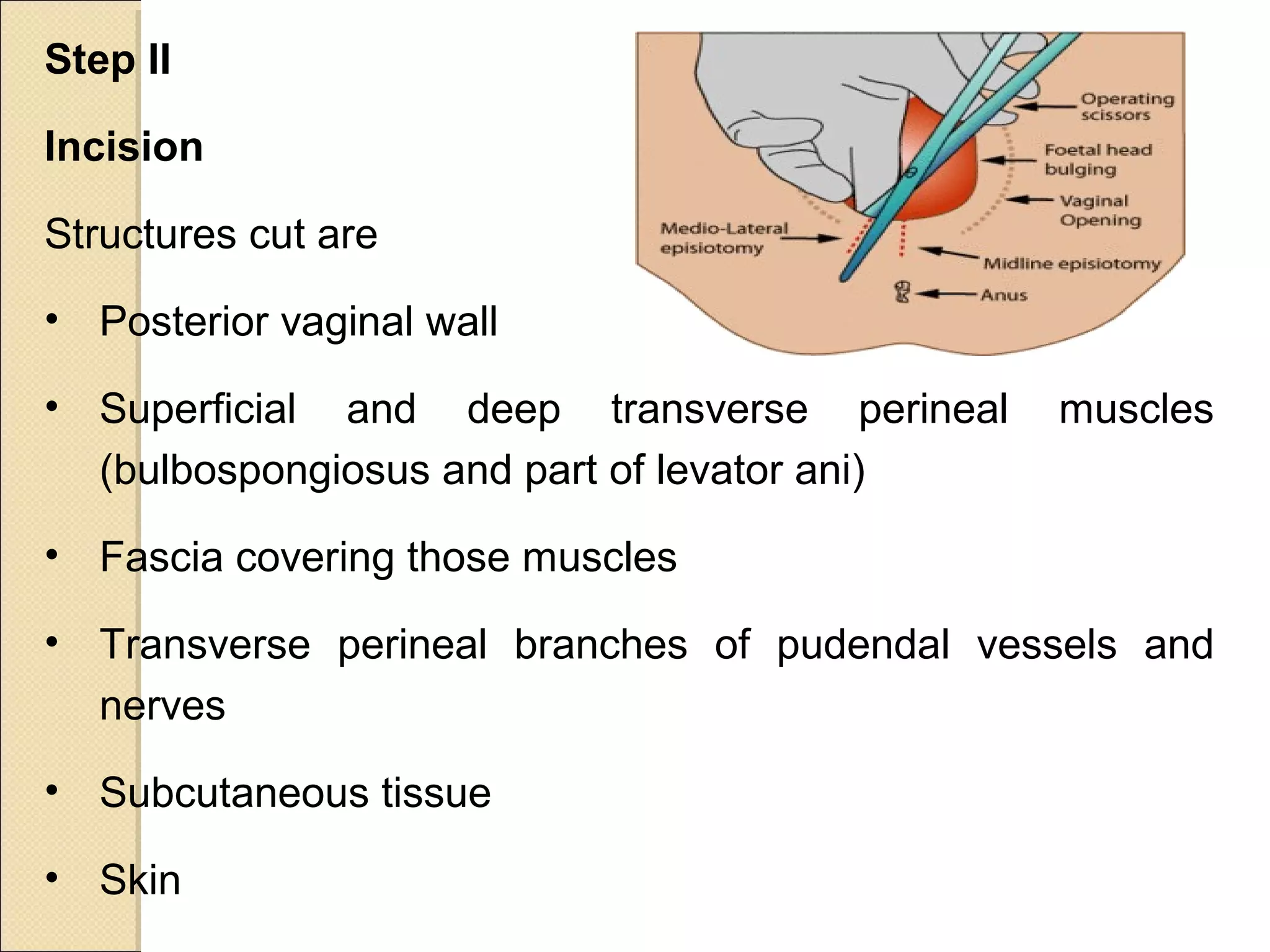 Episiotomy | PPT