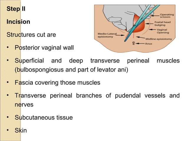 Episiotomy | PPT | Free Download