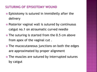 Episiotomy | PPTX