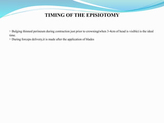 Episiotomy | PPTX