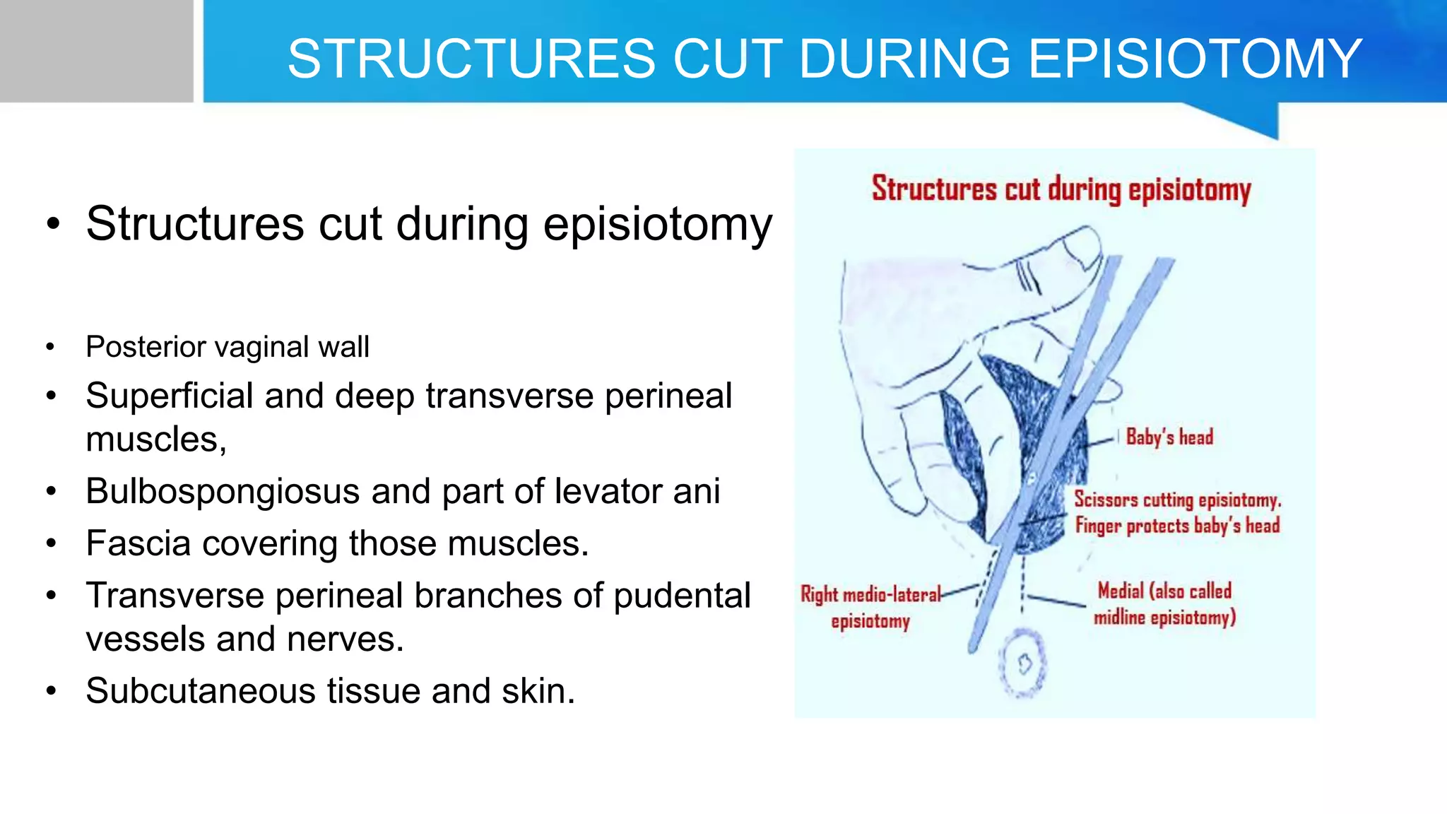 EPISIOTOMY.pptx