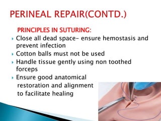 EPISIOTOMY AND ITS REPAIR.pptx