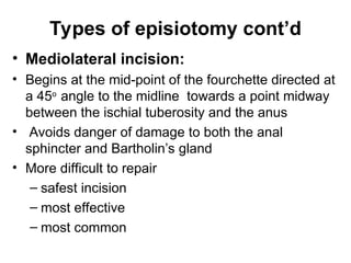 EPISIOTOMY CUTTING AND REPAIR EDITED VK.ppt