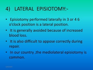 EPISIOTOMY P. | PPT