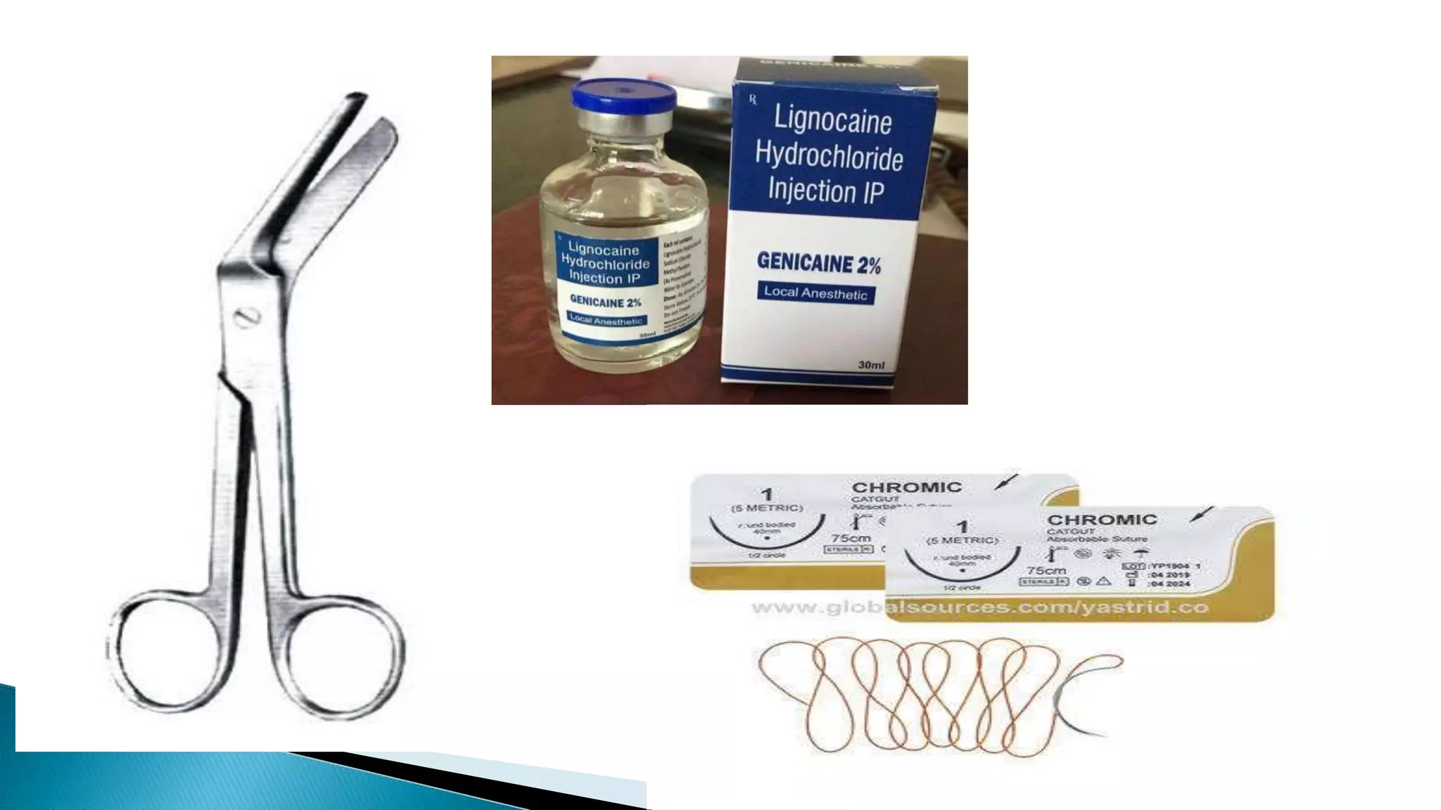 Episiotomy procedure | PPTX