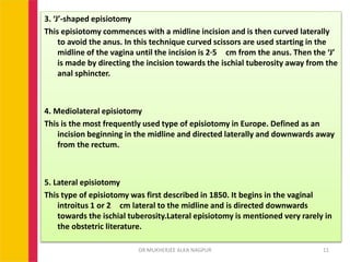 Episiotomy slideshare by dr alka mukherjee & dr apurva mukherjee ms | PPTX