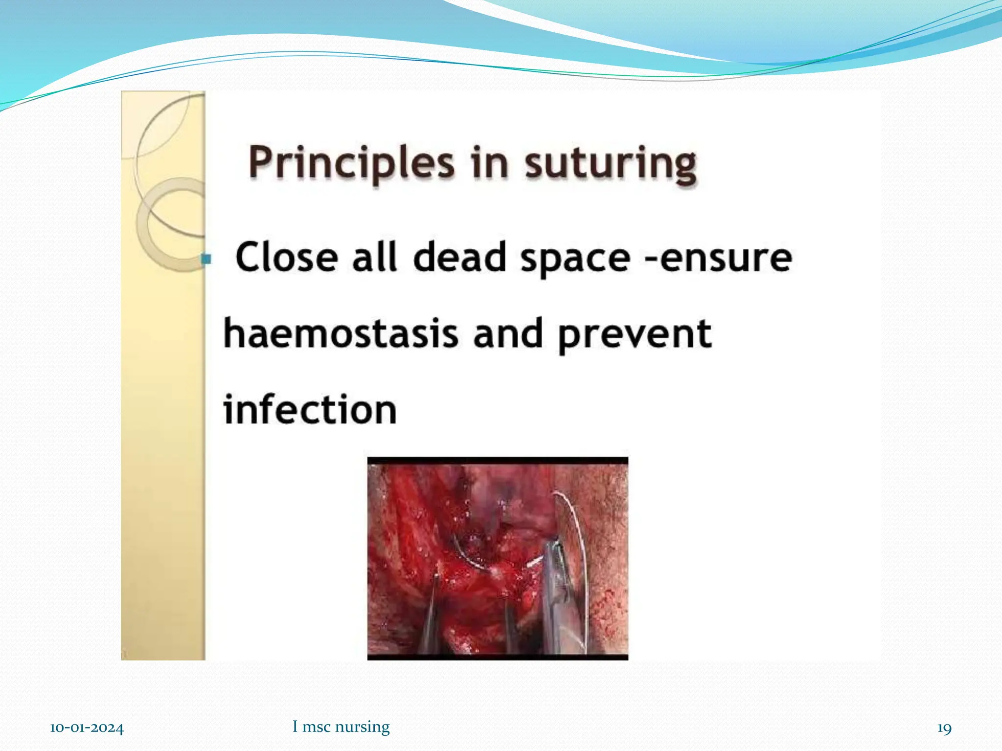 Episiotomy suturing.pptx
