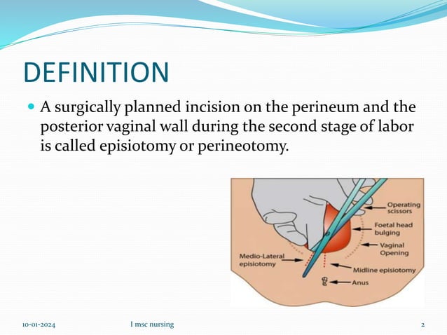 Episiotomy suturing.pptx | Pregnancy | Reproductive Health