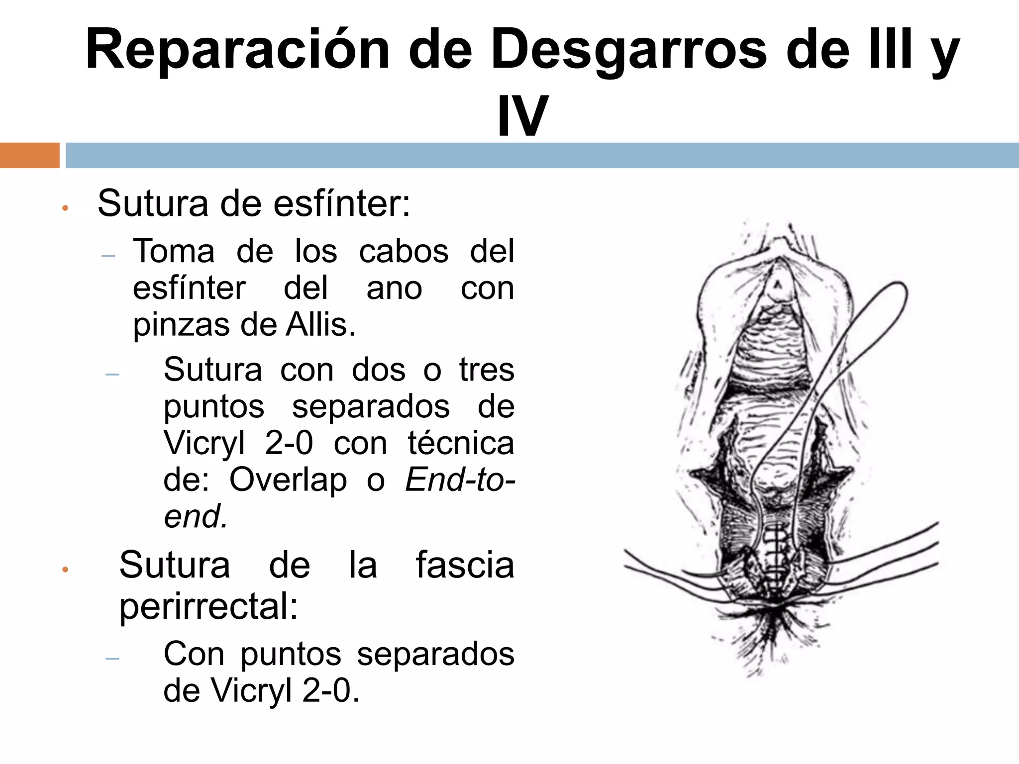 Episio y descarros GyO | PPTX