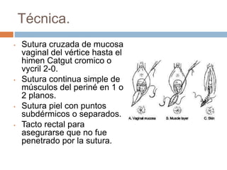 Episio y descarros GyO | PPTX