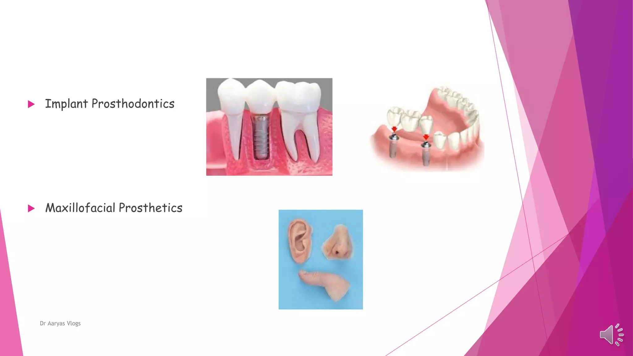 Introduction to Prosthodontics | PPTX