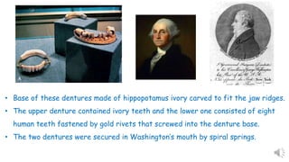 History of dentures | PPT