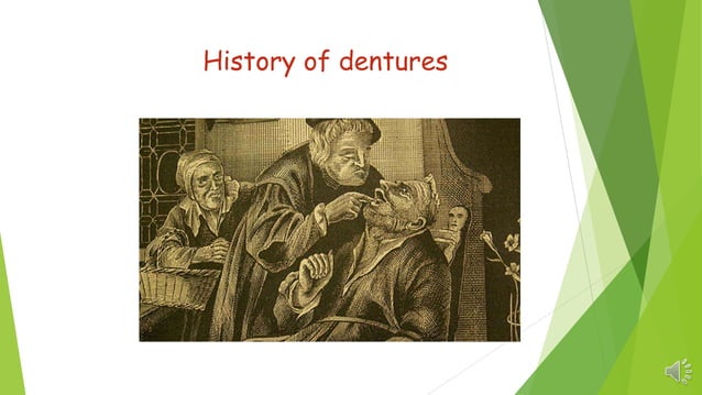 History of dentures | PPT