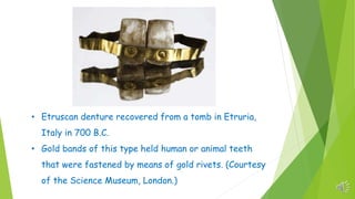 History of dentures | PPT