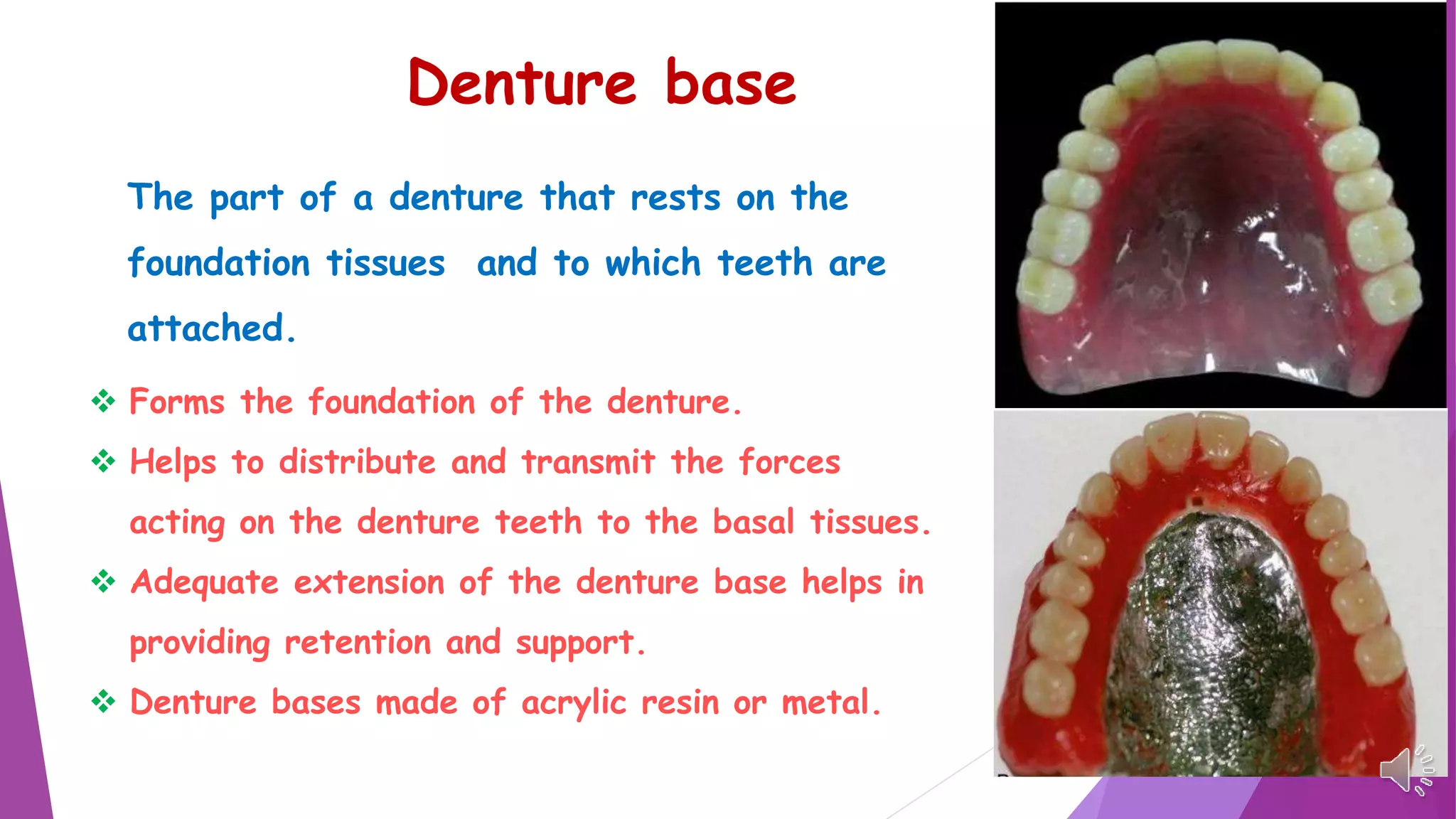 Components of a complete denture | PPTX