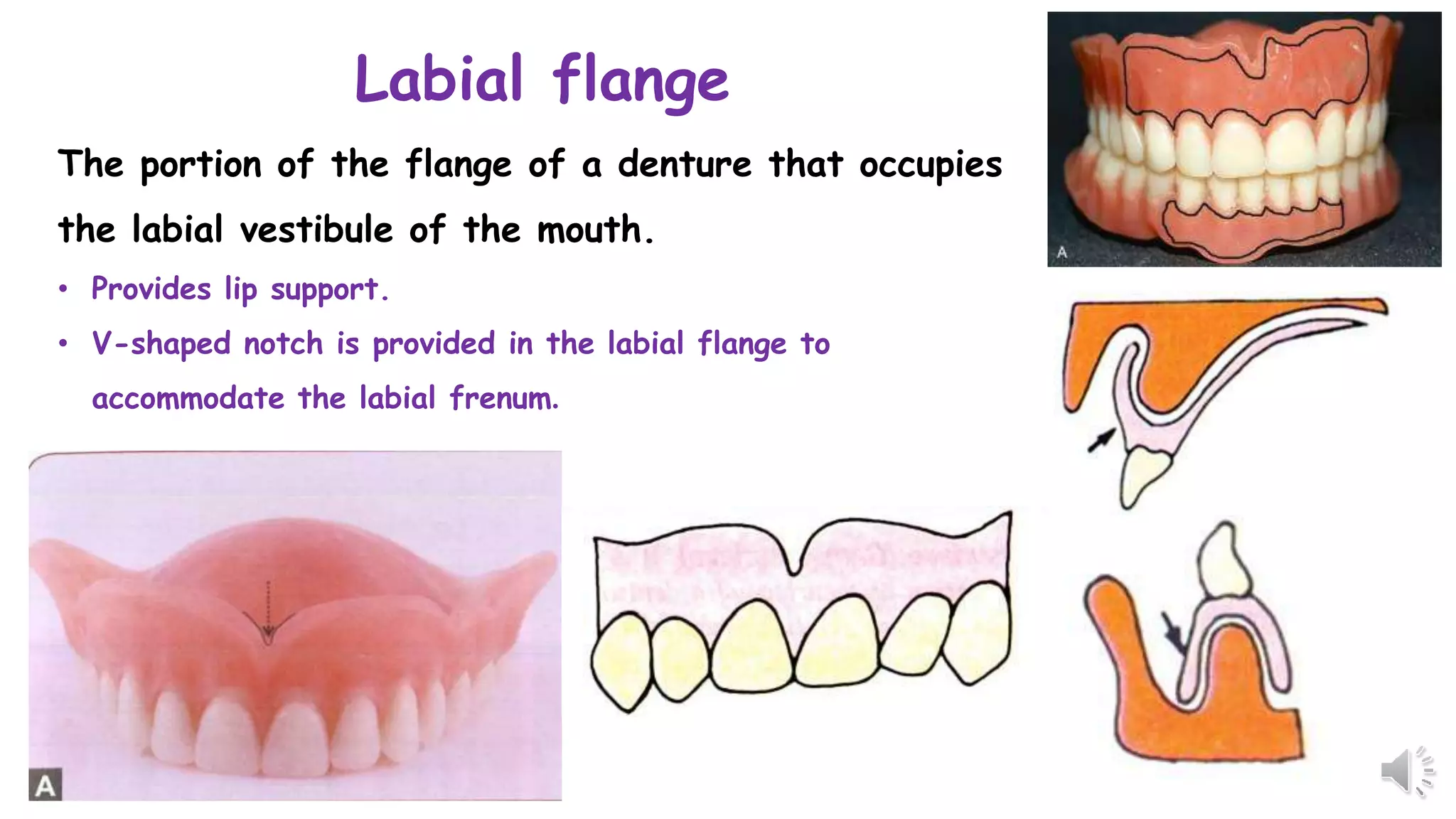Components of a complete denture | PPTX
