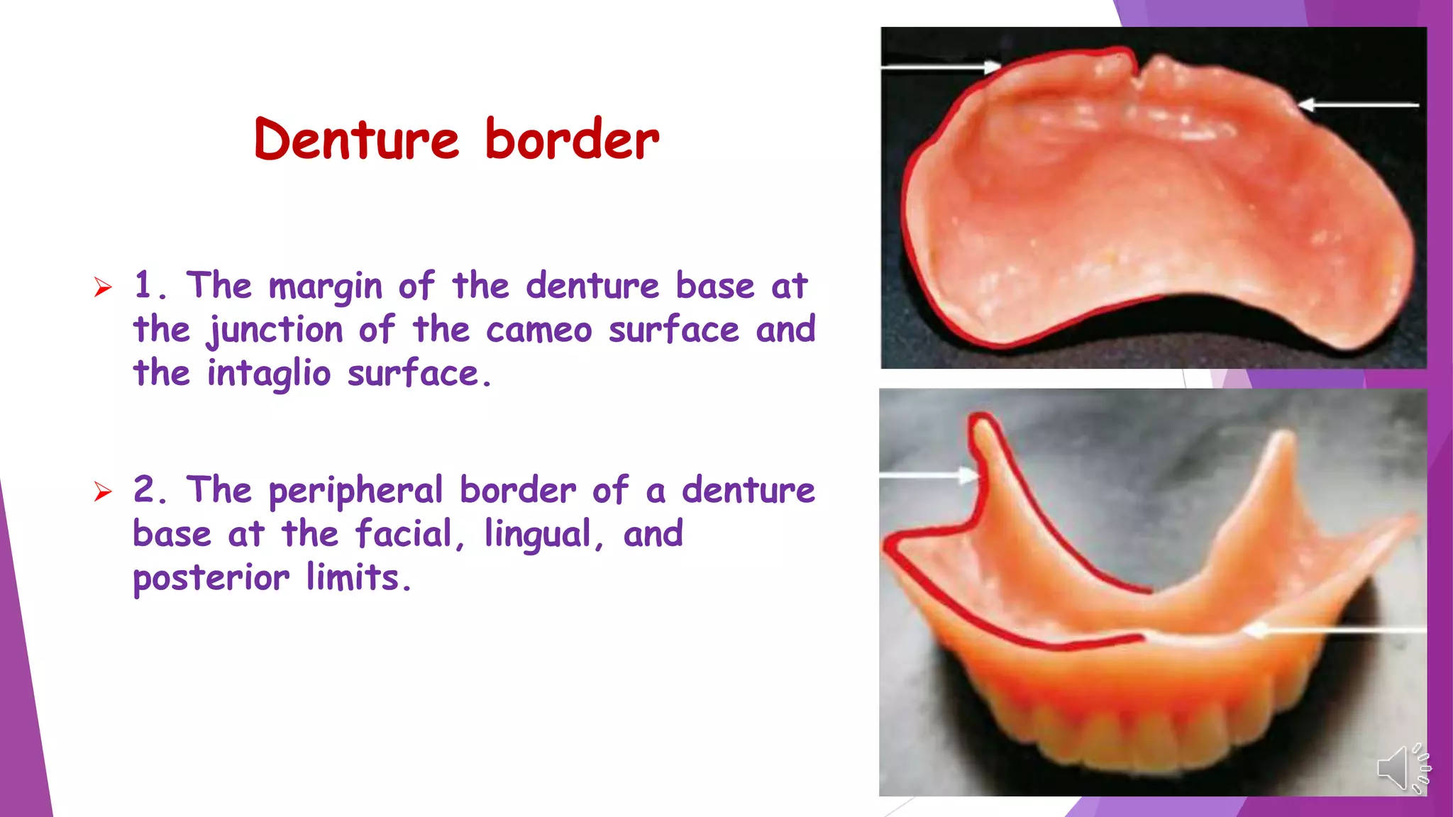 Components of a complete denture | PPTX