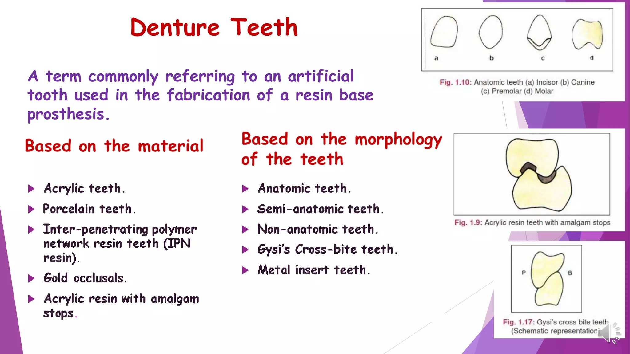 Components of a complete denture | PPTX