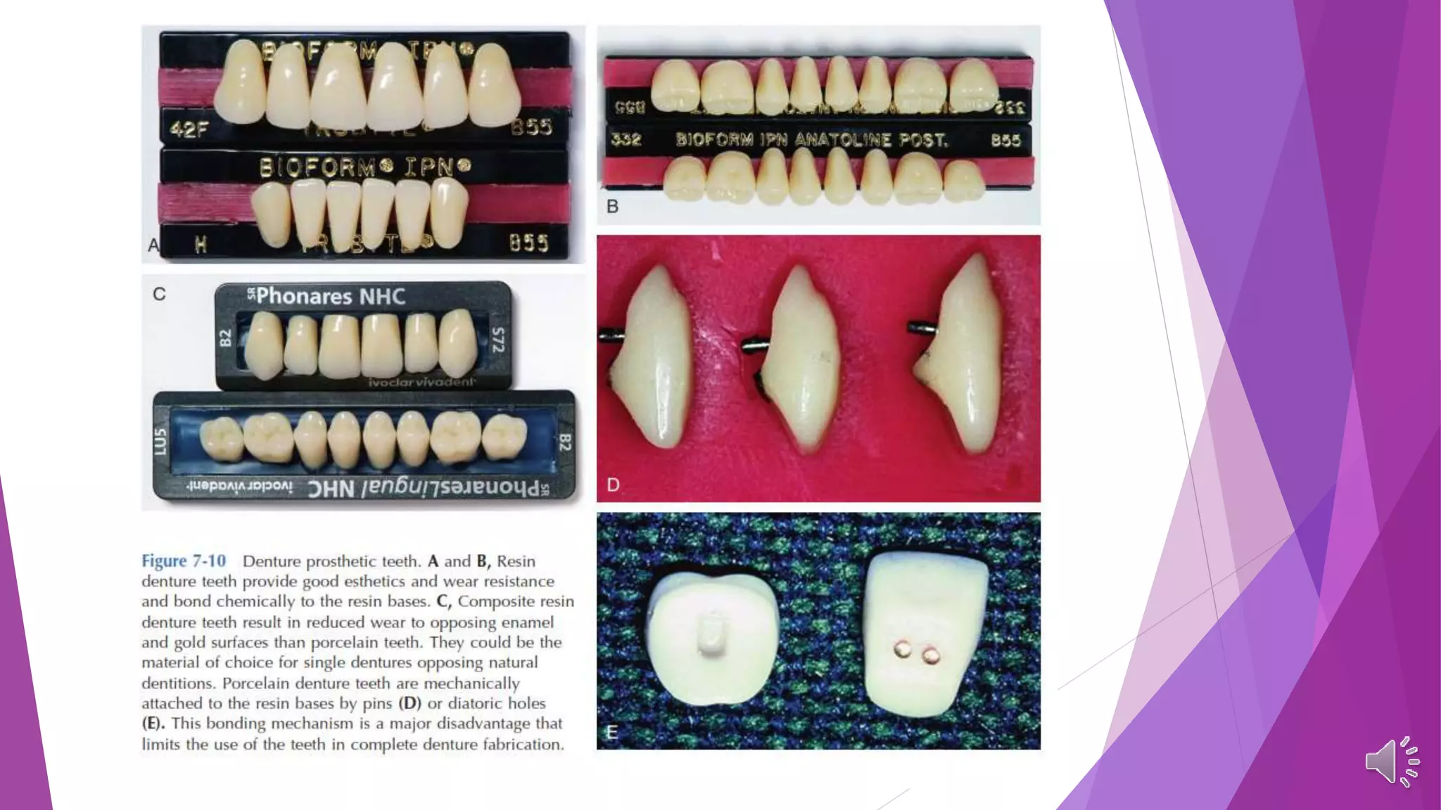 Components of a complete denture | PPTX