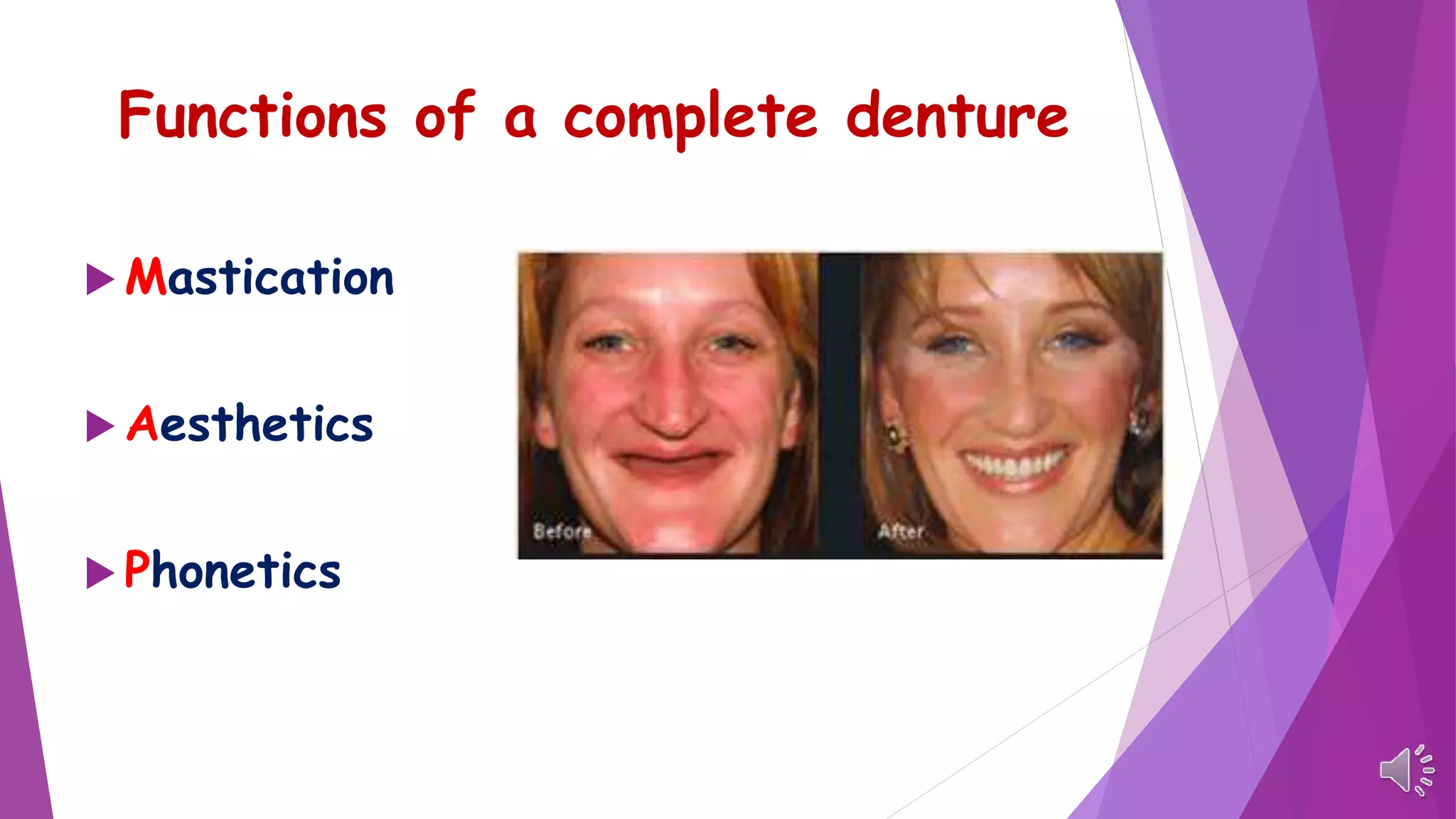 Components of a complete denture | PPTX