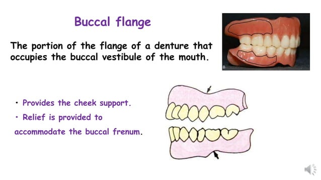 Components of a complete denture | PPTX