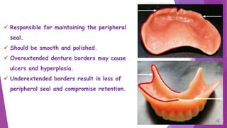 Components of a complete denture | PPTX