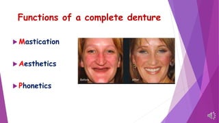 Components of a complete denture | PPTX