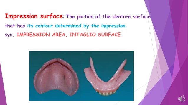 Components of a complete denture | PPTX