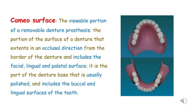 Components of a complete denture | PPTX