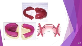 Components of a complete denture | PPTX