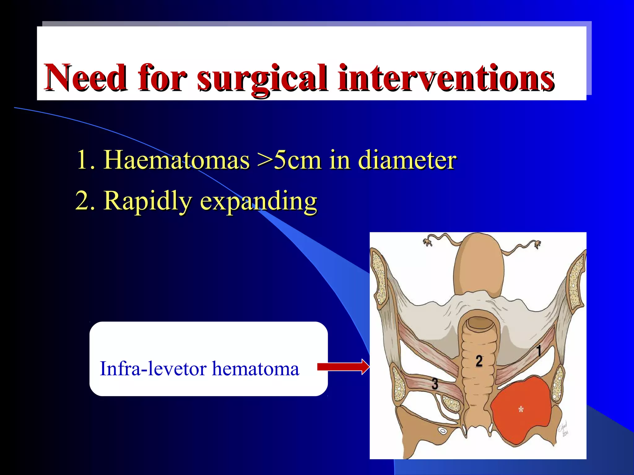 Episotomy for undergraduate | PPT