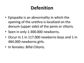 Management of Epispadia | PPTX