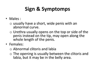 Management of Epispadia | PPTX