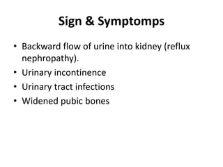 Management of Epispadia | PPTX